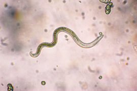 How to Get Rid of Parasites for Good : 12 Efficient Ways - Naturally Daily