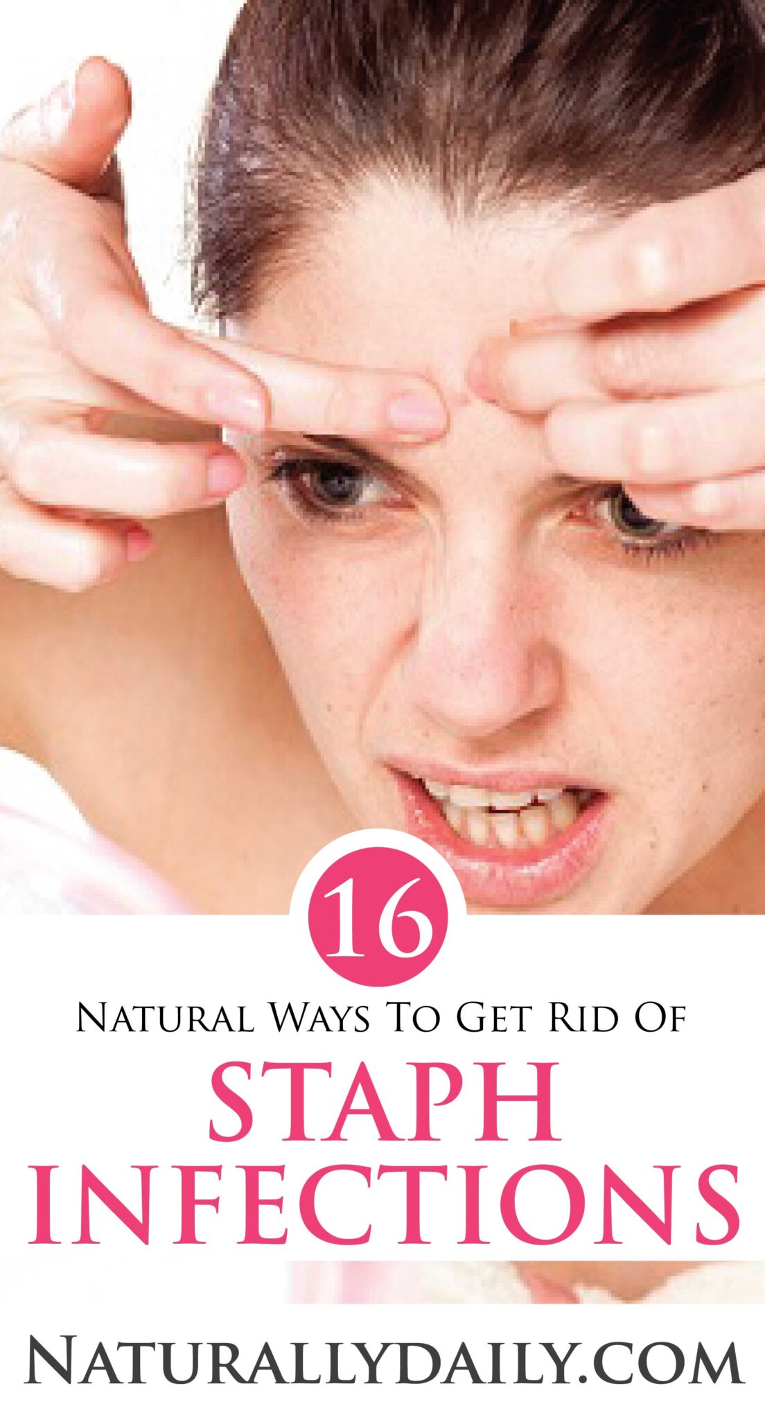 How to Get Rid of Staph Infections: 16 Sure Natural Ways - Naturally Daily