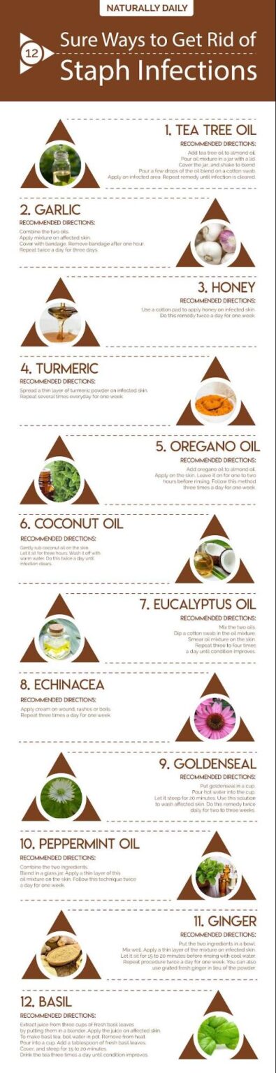 How to Get Rid of Staph Infections: 16 Sure Natural Ways - Naturally Daily