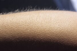 Can You Get Rid of Peach Fuzz Using Natural Home Remedies - Naturally Daily