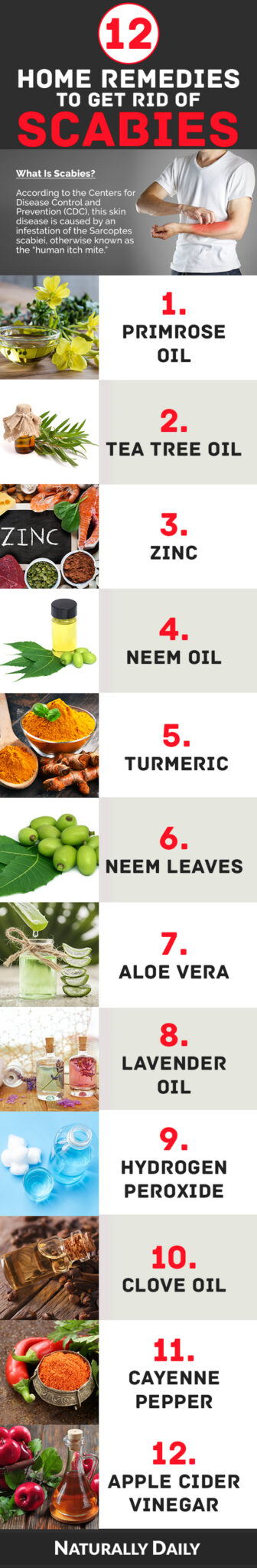 12 Home Remedies to Get Rid of Scabies Naturally - Naturally Daily