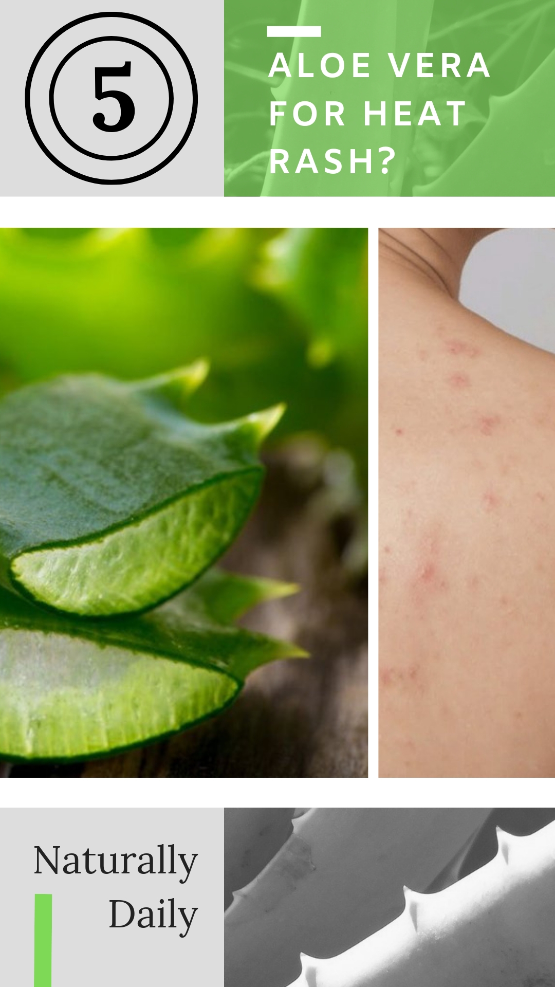 How to Get Rid of Heat Rash: 19 Fast Home Remedies - Naturally Daily