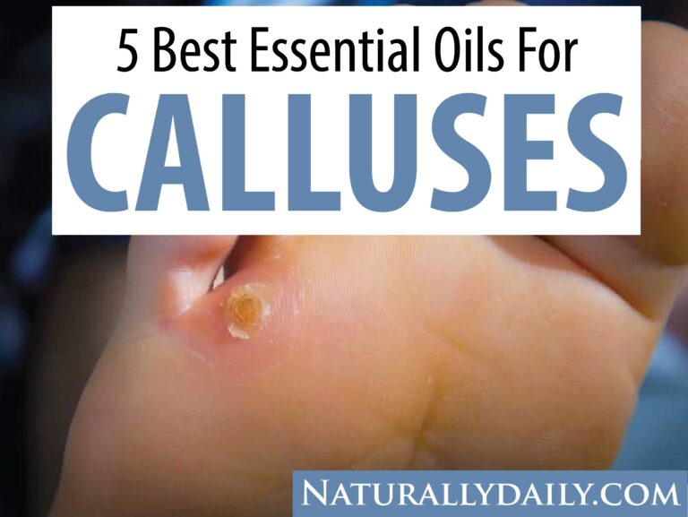 10 Best Essential Oils For Moth Repellent: Closet, Clothes, Pantry - Naturally Daily