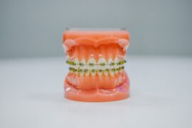 12 Best Essential Oils for Toothache, Abscess, and Infection