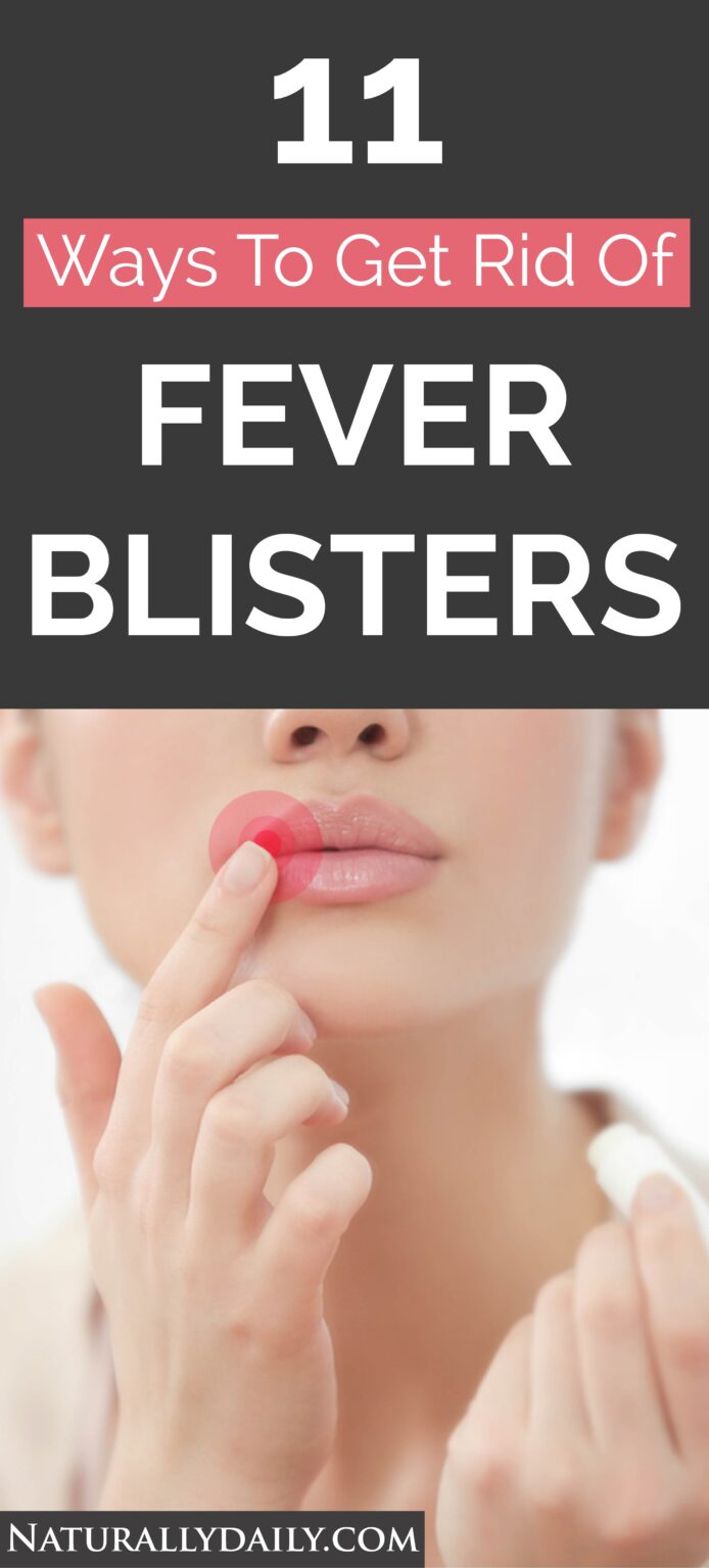 How to Get Rid of Blisters: 24 Possible Home Remedies