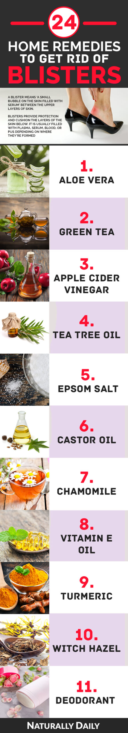 How to Get Rid of Blisters: 24 Possible Home Remedies